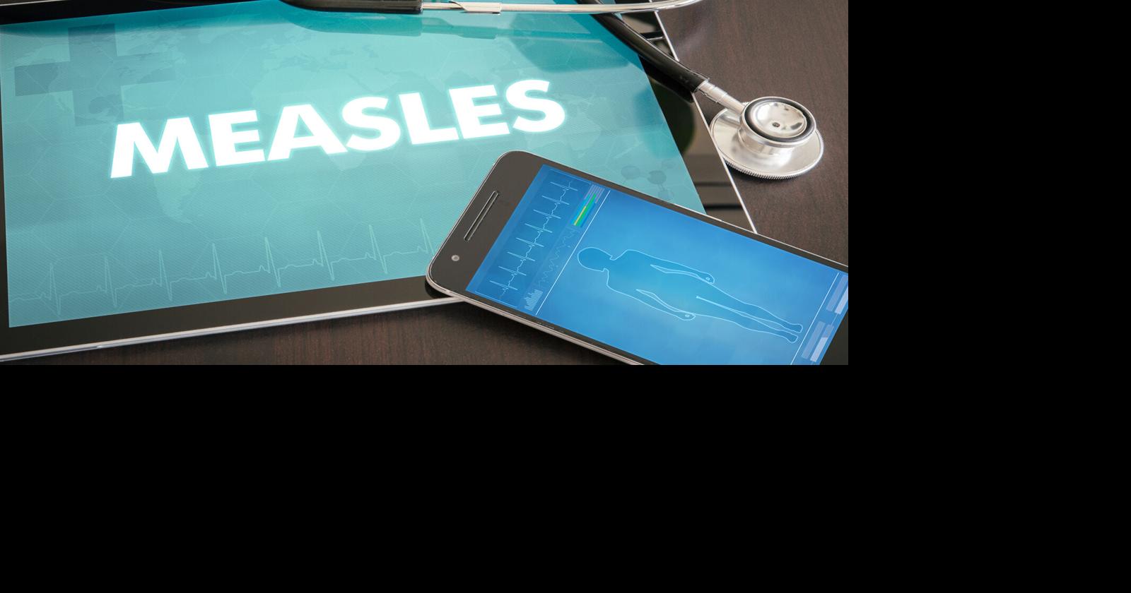 Measles outbreak: 4 things to know about the current spread | Health ...