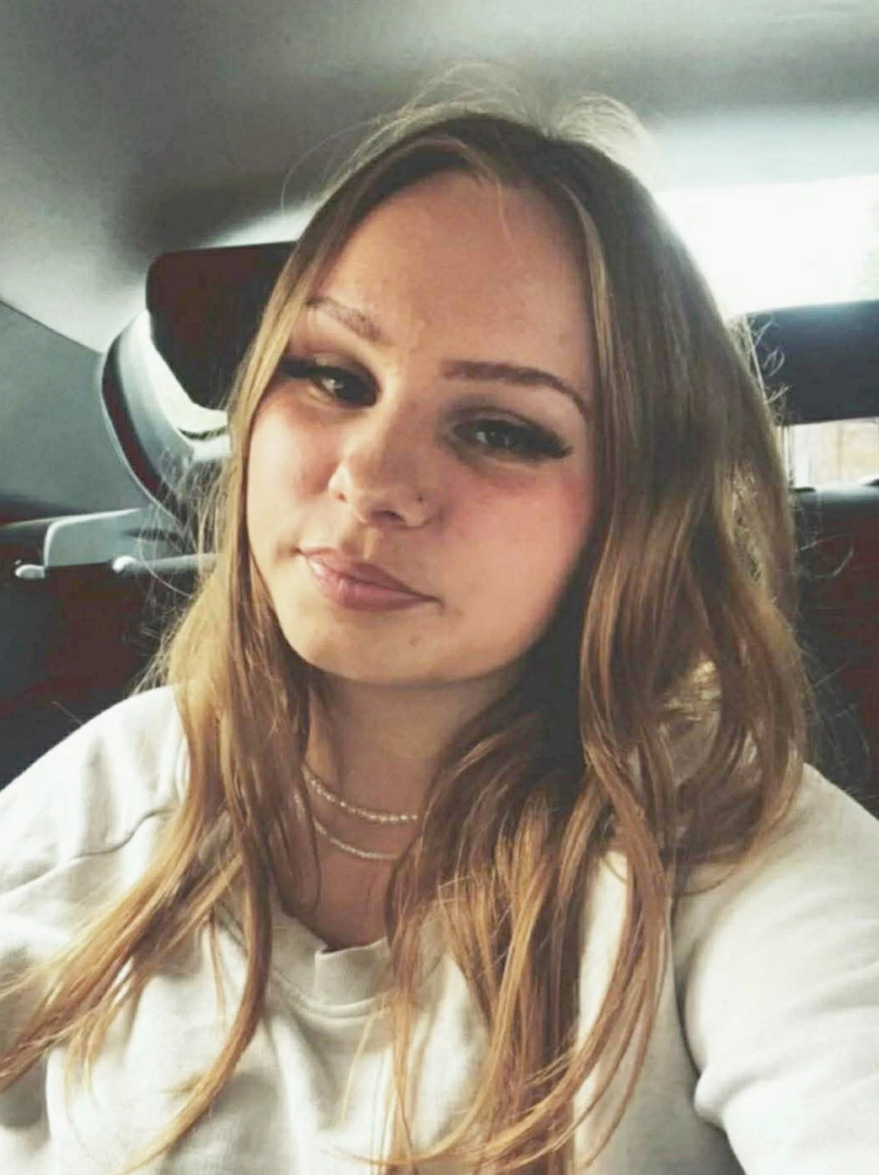 Teen’s spinal stroke dismissed as ‘period pain’ | Health | gpkmedia.com