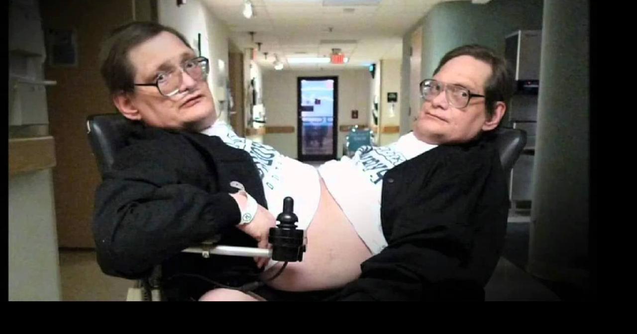 Ohio conjoined brothers marking a milestone | News | grandhaventribune.com