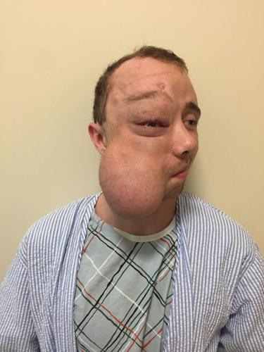 Dr. Greg and the 8 pound tumor