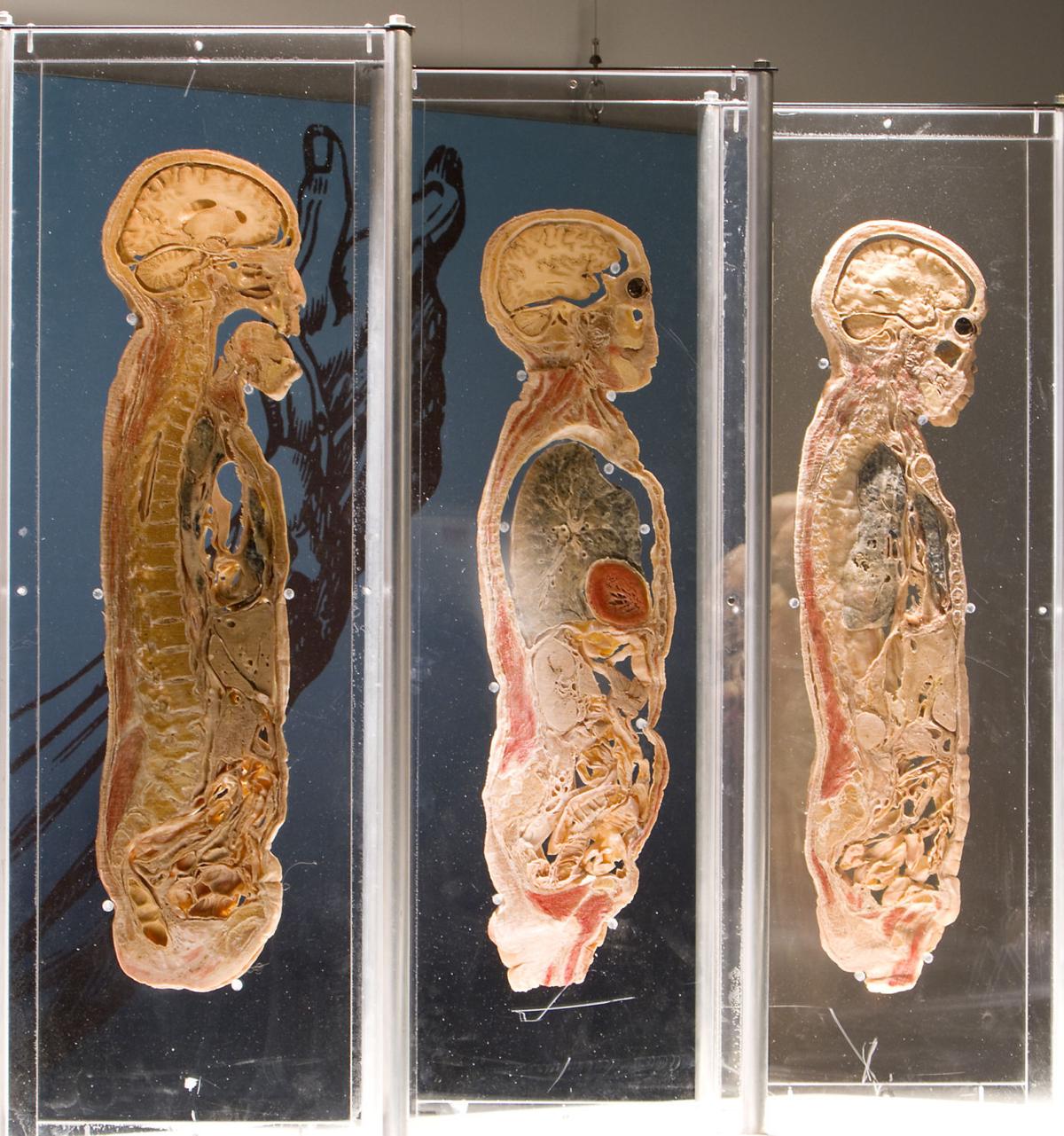 'Bodies Revealed' returns to Science Center | Life | greensboro.com