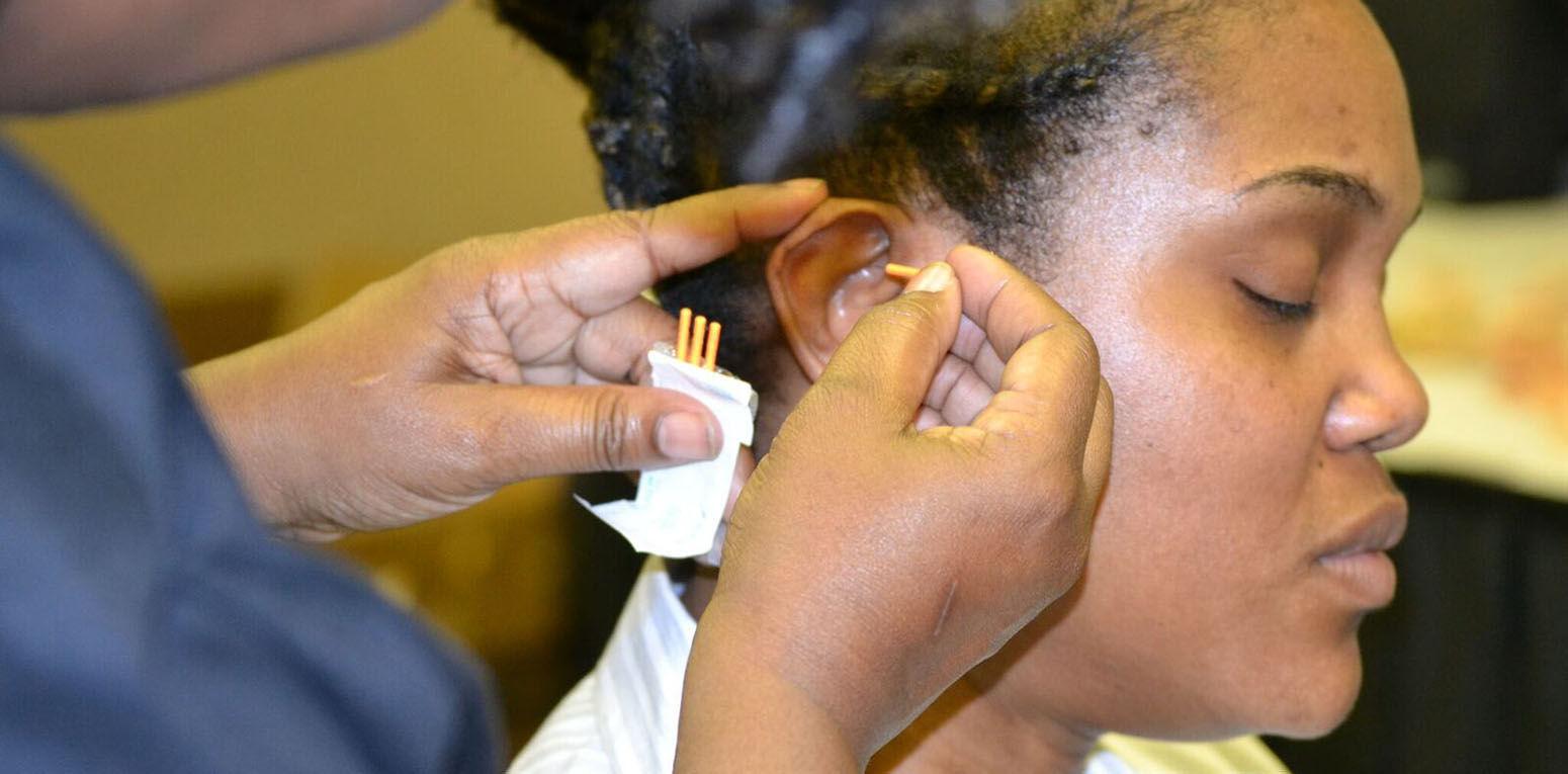 Acupuncture procedure licensed to alleviate withdrawal in drug ...