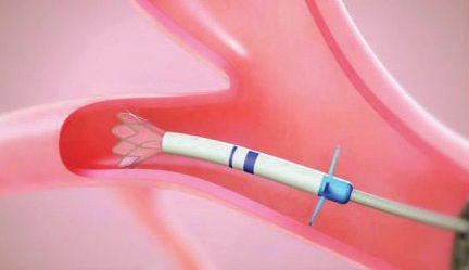 Cabell Huntington Hospital first in West Virginia to use the Zephyr ...