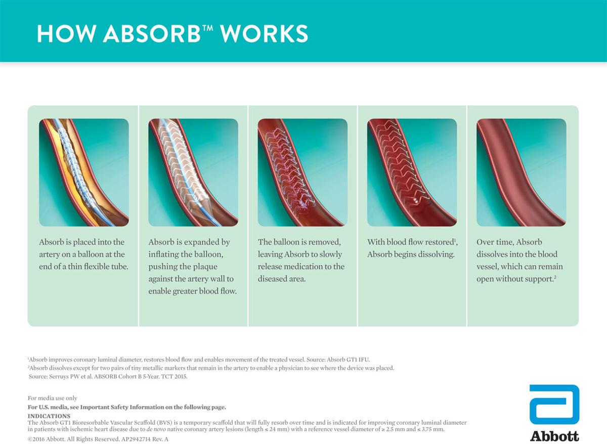 St. Mary’s Regional Heart Institute advances cardiology service by ...