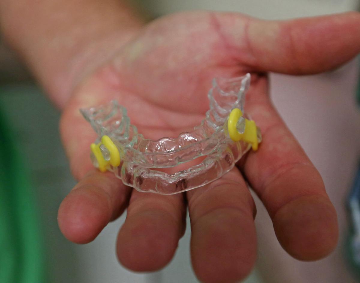 In-mouth piece an easier option for sleep apnea sufferers | News ...