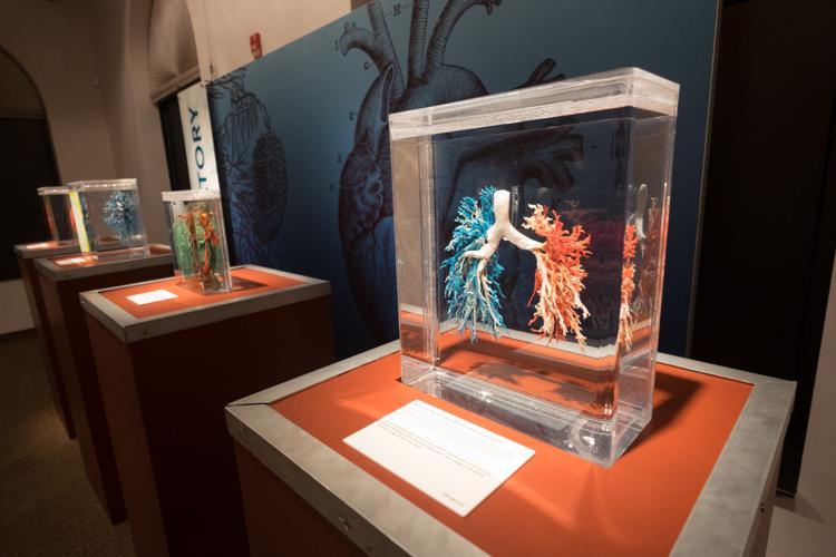 Photos: "Bodies Revealed" exhibit in Gallipolis | Photo Galleries ...