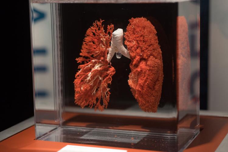 Photos: "Bodies Revealed" exhibit in Gallipolis | Photo Galleries ...