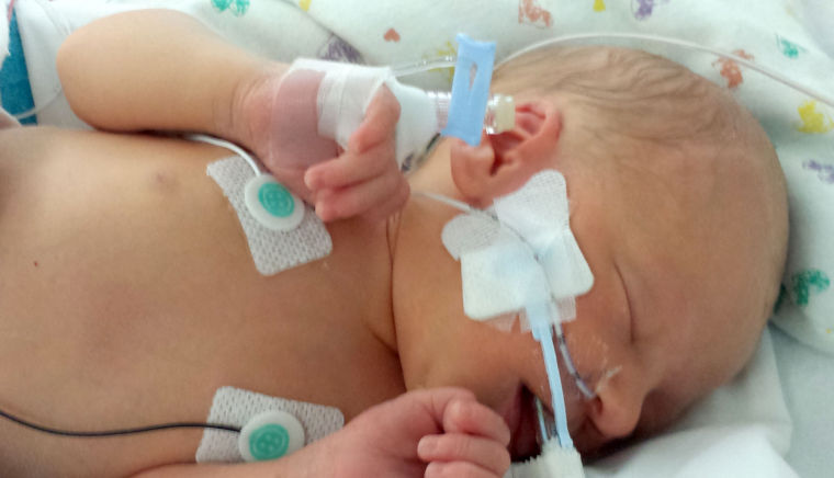 Growing problem of drug-addicted babies gets officials’ attention