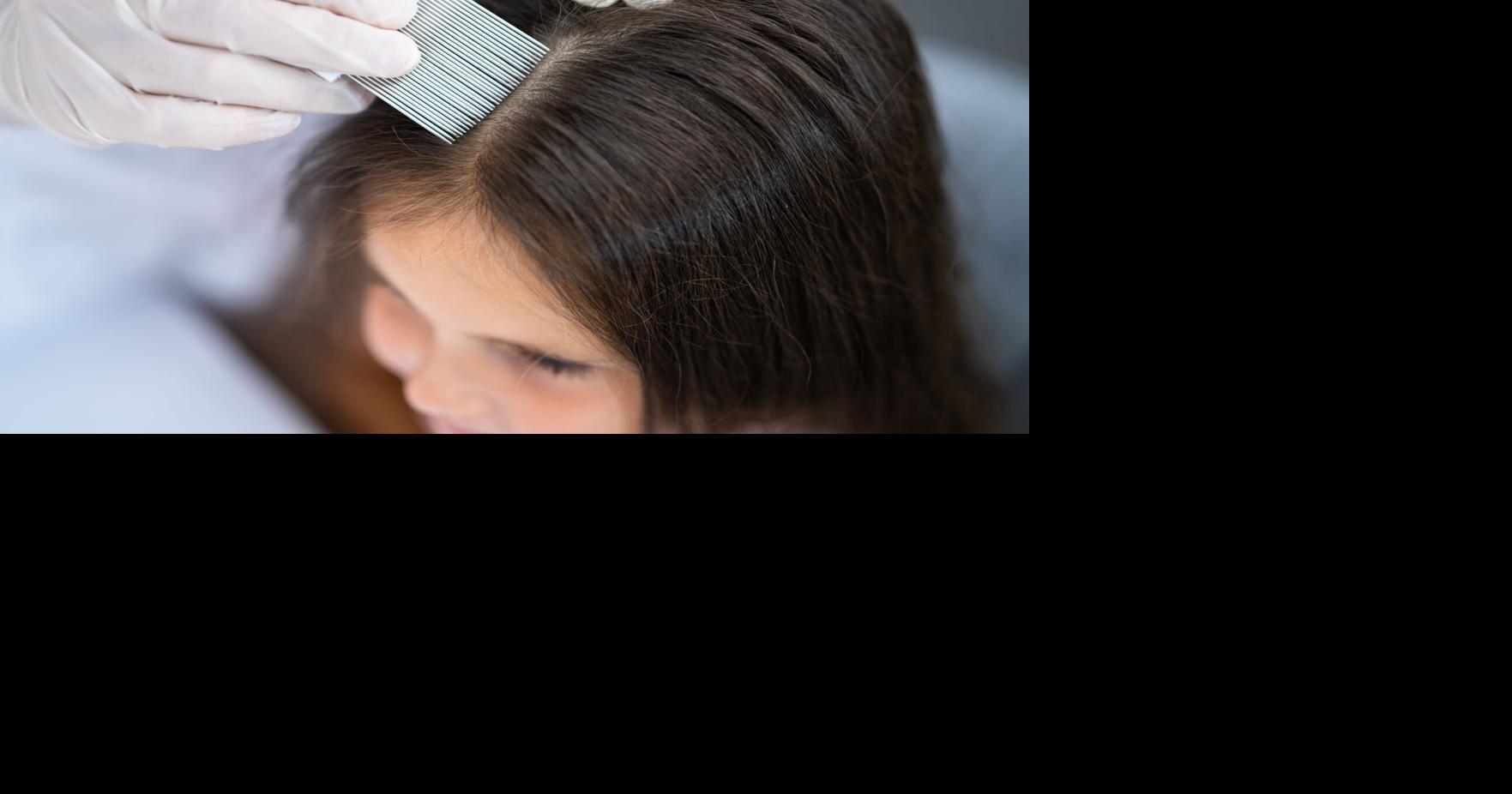 MayPort-CG eyes changes to its handling of lice cases | News ...