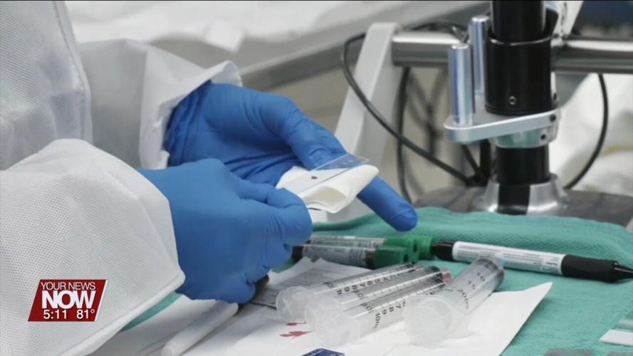 Gene therapy shows positive initial results in Sickle Cell patients ...