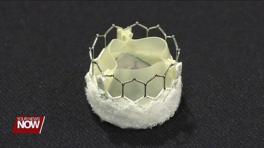 Lima Memorial celebrates the lives saved thanks to the TAVR procedure ...