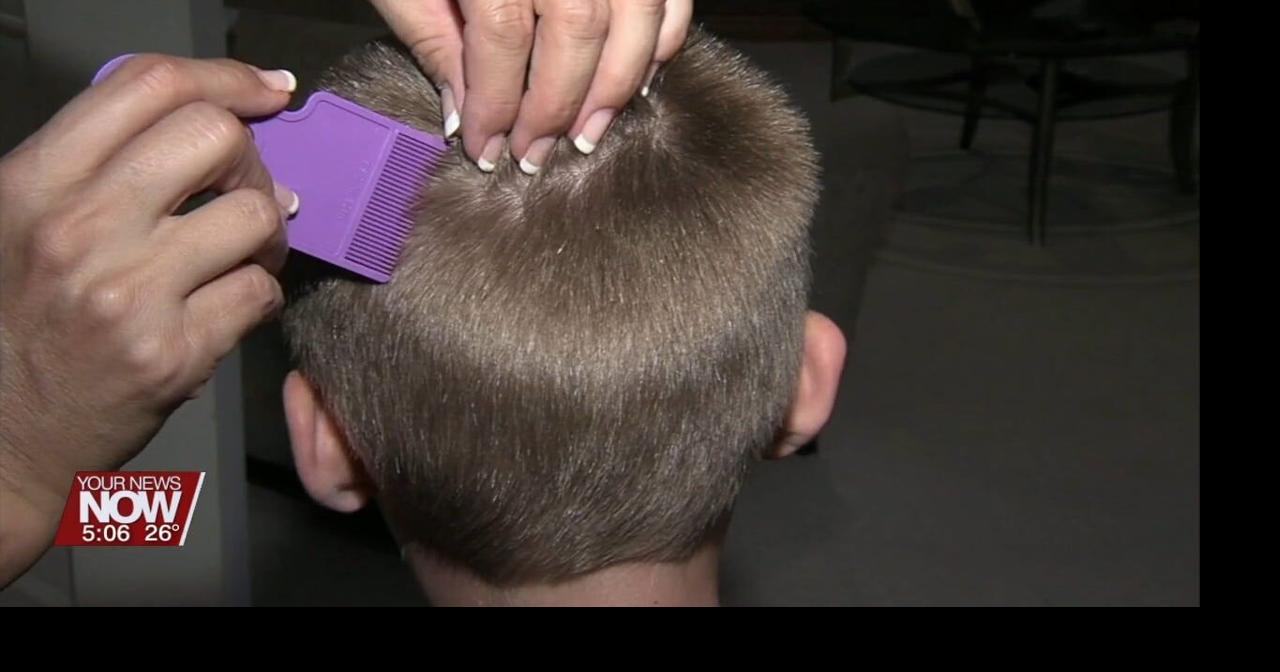 What to do if your child gets lice at school | News | hometownstations.com