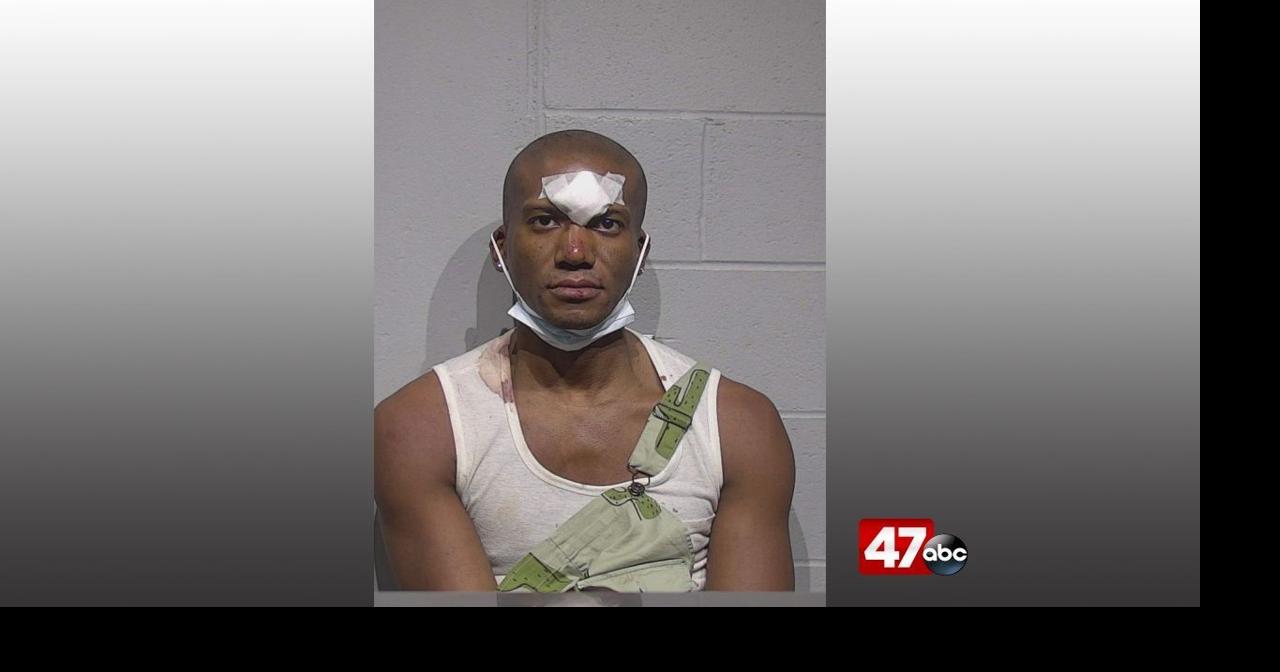 OCPD officer and suspect injured during DUI arrest | Crime | hub.wmdt.com
