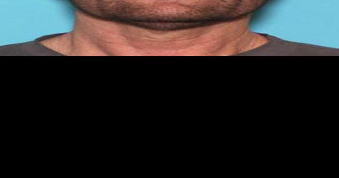 Attorneys in Ross case given more time; judge allows additional windows ...