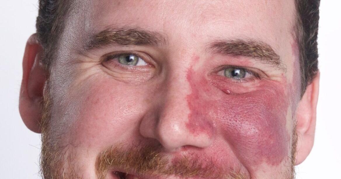 THOMAS LOTT COLUMN: Manfred, MLB have created their own pickle