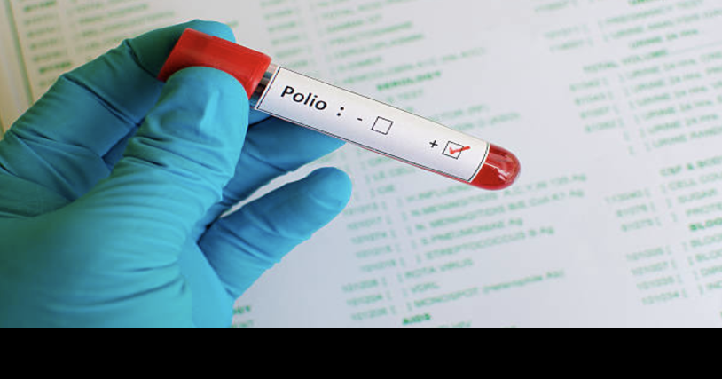 What to Know About Polio: Symptoms and Prevention