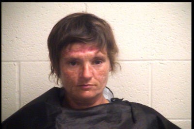 Deputies: Mauling victim among 2 facing meth charges | Crime ...