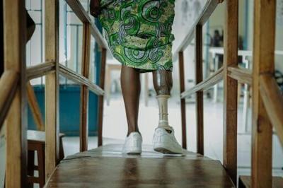 A patient tests her new prosthesis at the Shirika la Umoja centre in ...