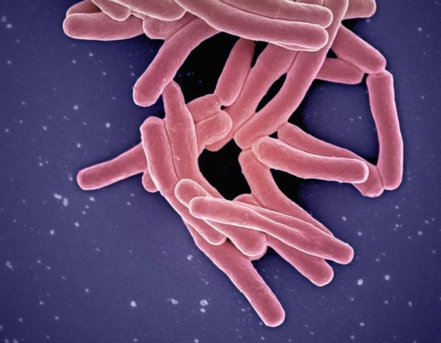 How this deadly superbug spread and rose to global dominance | Health ...