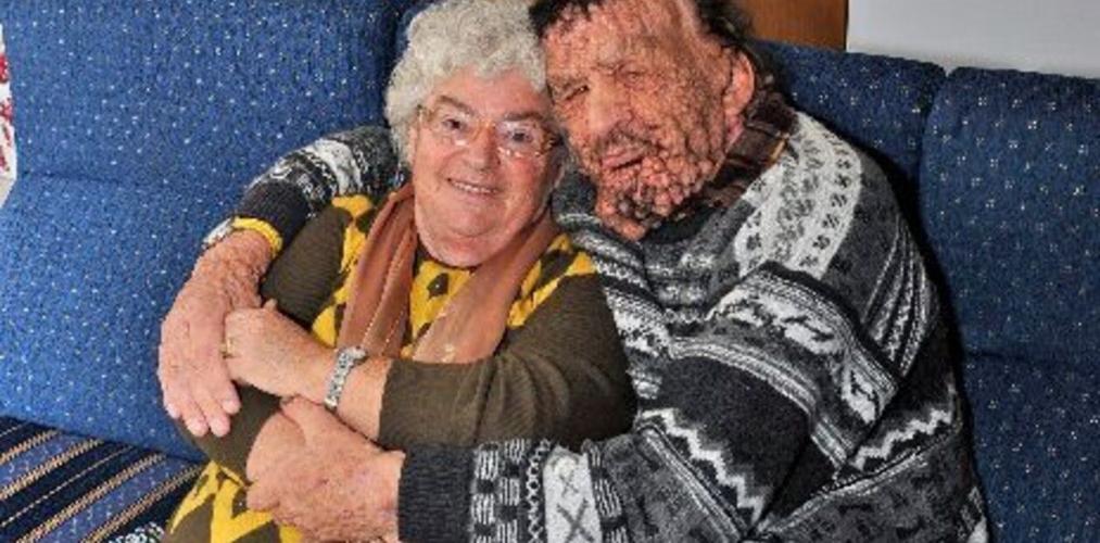 Fallece Vinicio, el hombre enfermo cuyo abrazo con el Papa Francisco ...