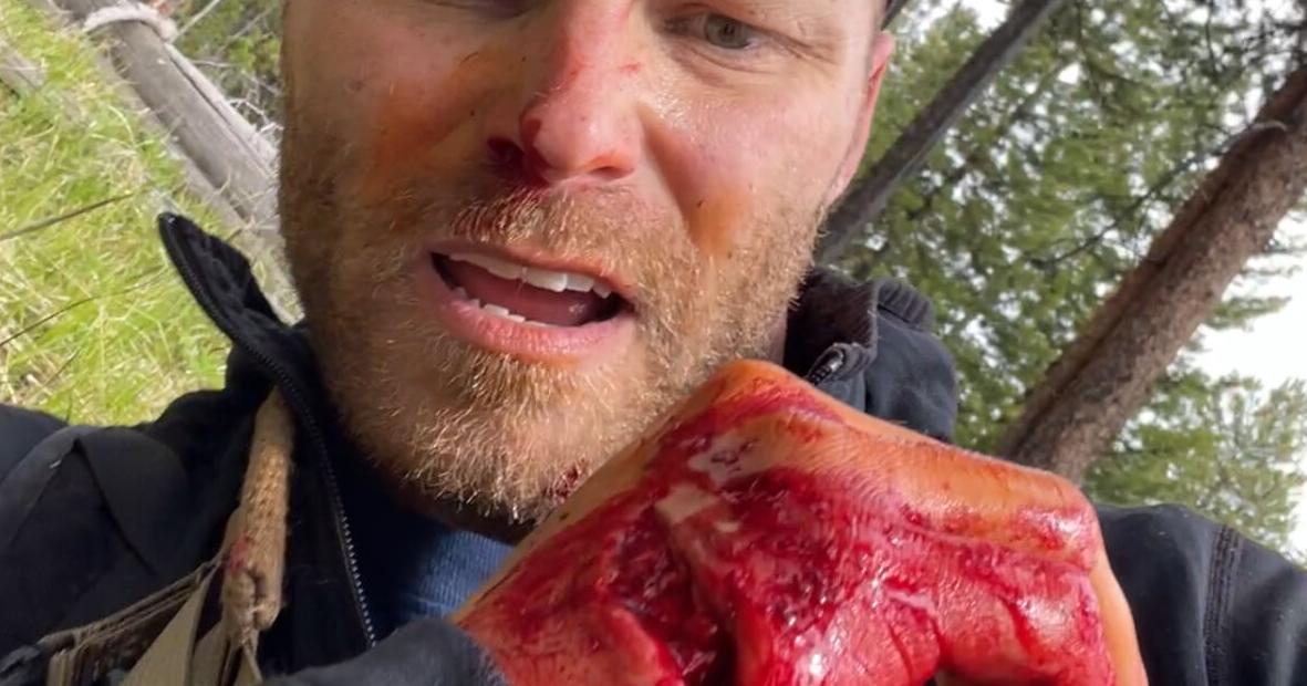 i was bitten bear attack