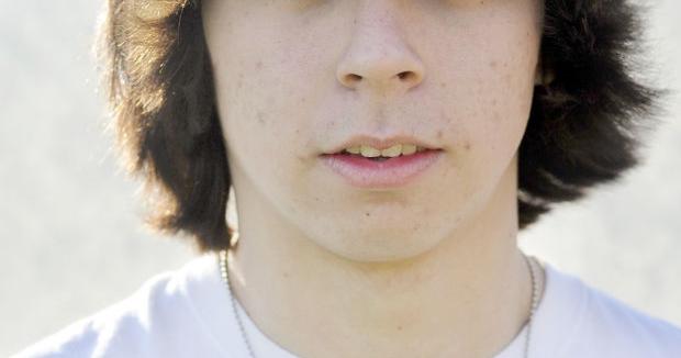 Focus On: Keven White