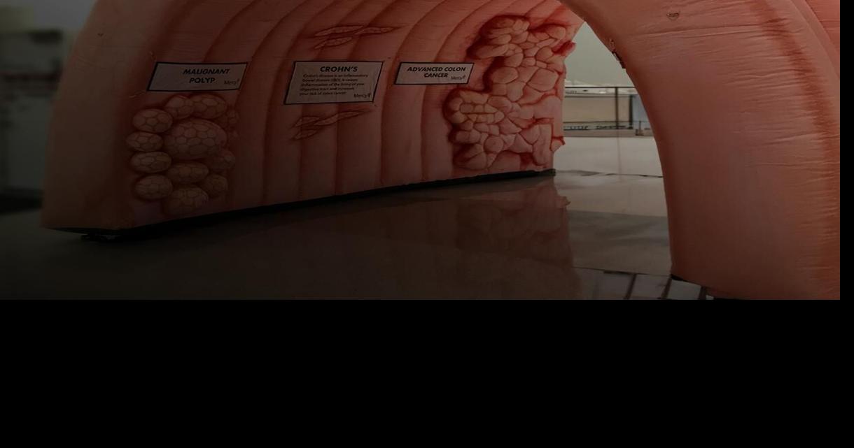 Killeen health fair to feature walk-through, inflatable colon | Local ...