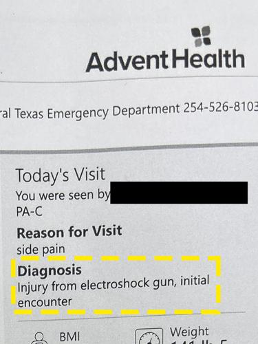 Mother says son shot with Taser at Killeen school; KISD officials deny ...