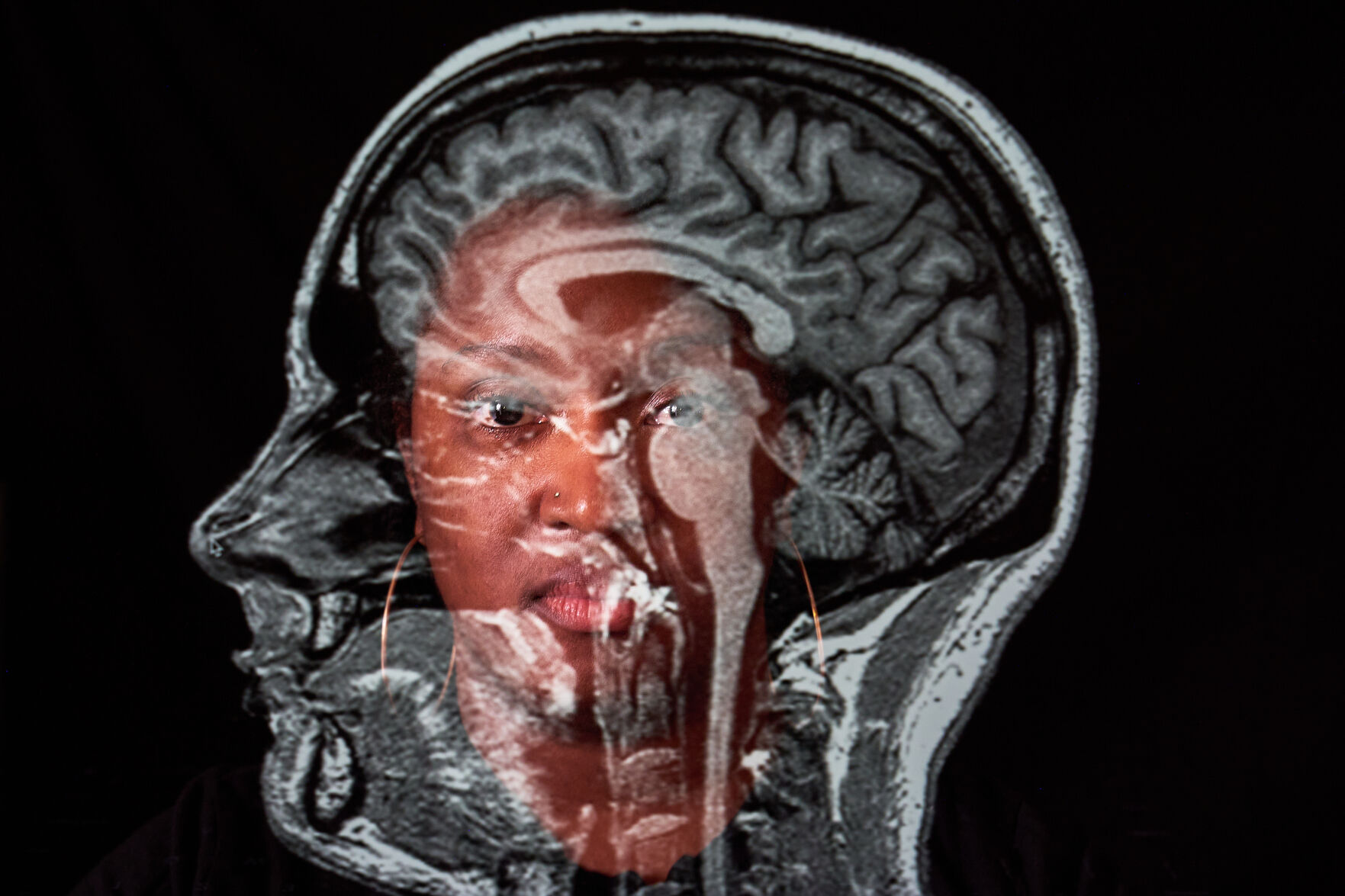 Autoimmune Diseases Brain | Living | kdhnews.com