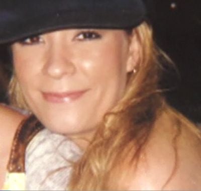 Burned wife speaks out on abuse, shares story of survival | News ...