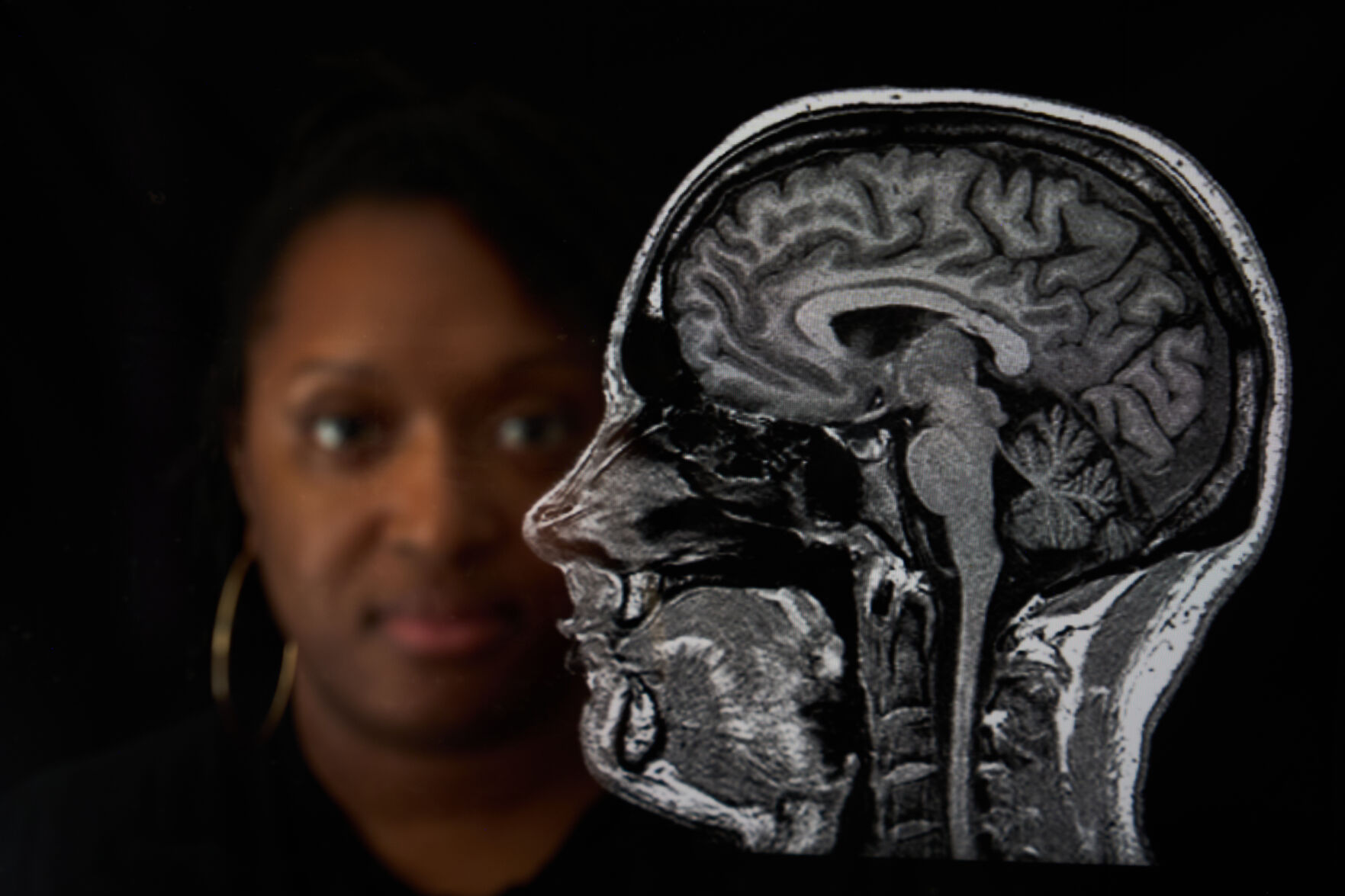 Autoimmune Diseases Brain | Living | kdhnews.com