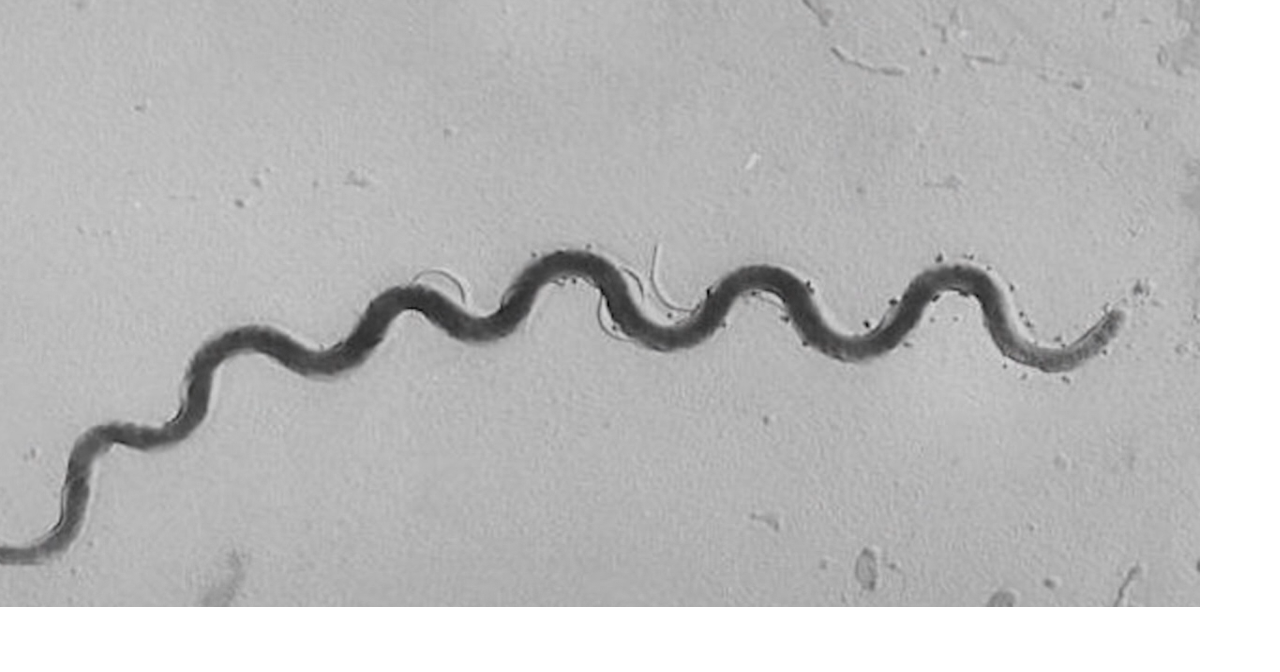 Syphilis rates surging across Oregon | HealthWatch | kdrv.com