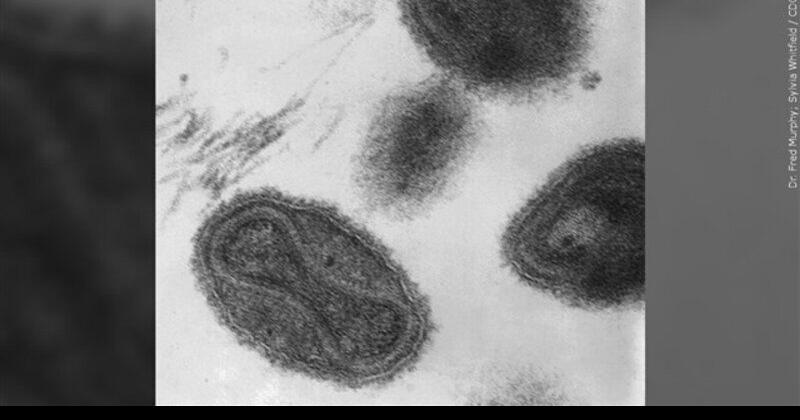 'Smallpox' vials found at Pennsylvania lab do not contain the virus ...