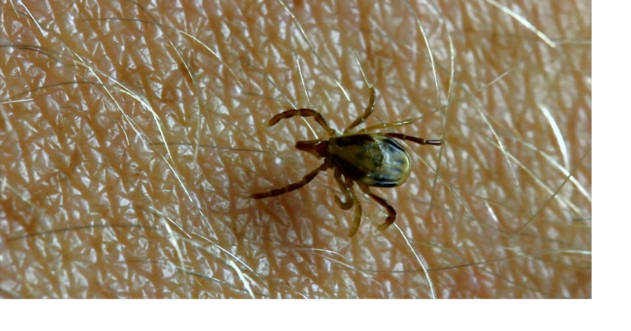 Tick prevention and protection | News | kdrv.com