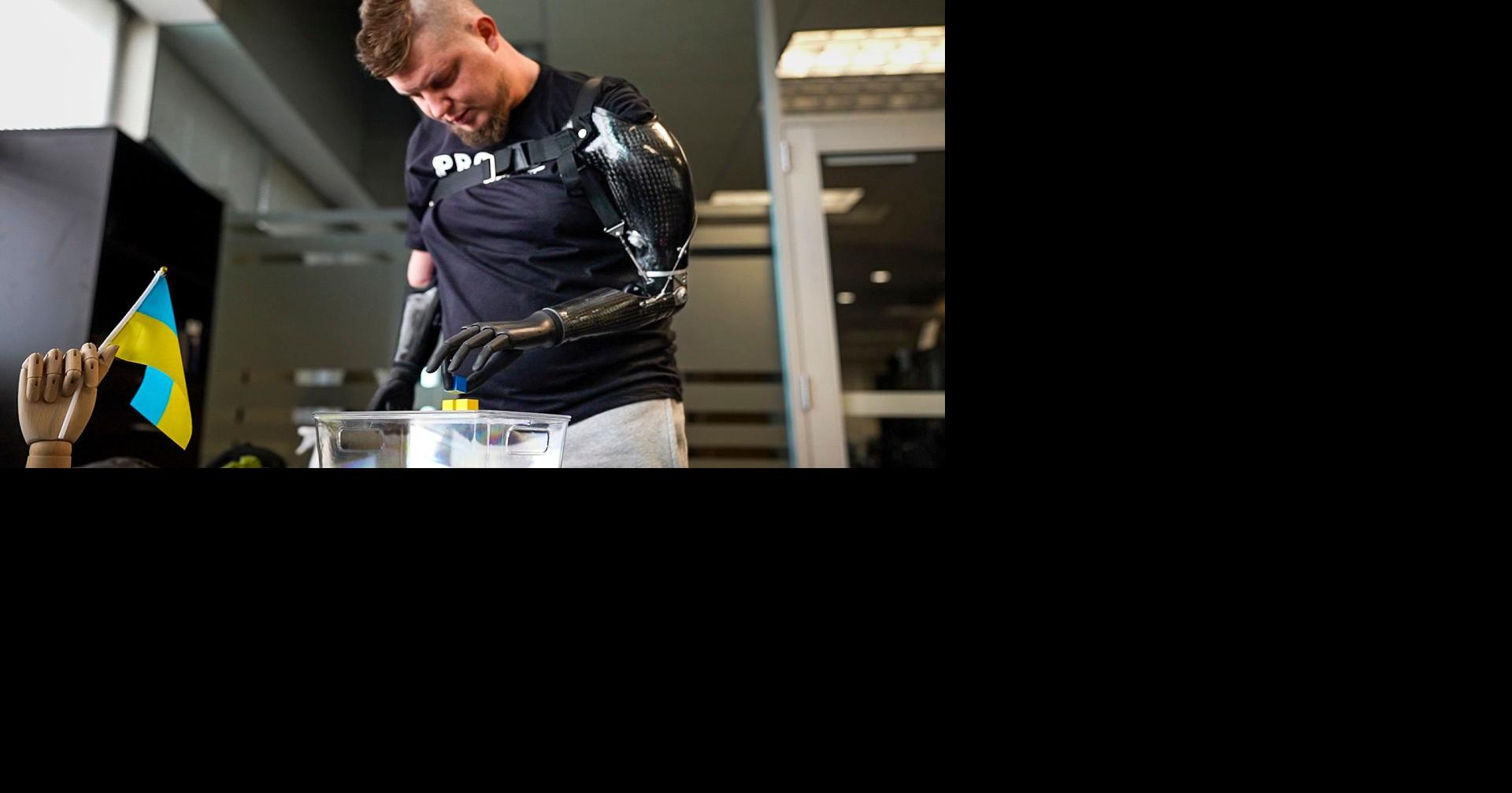 How AI and bionics are helping Ukrainian soldiers return to action ...