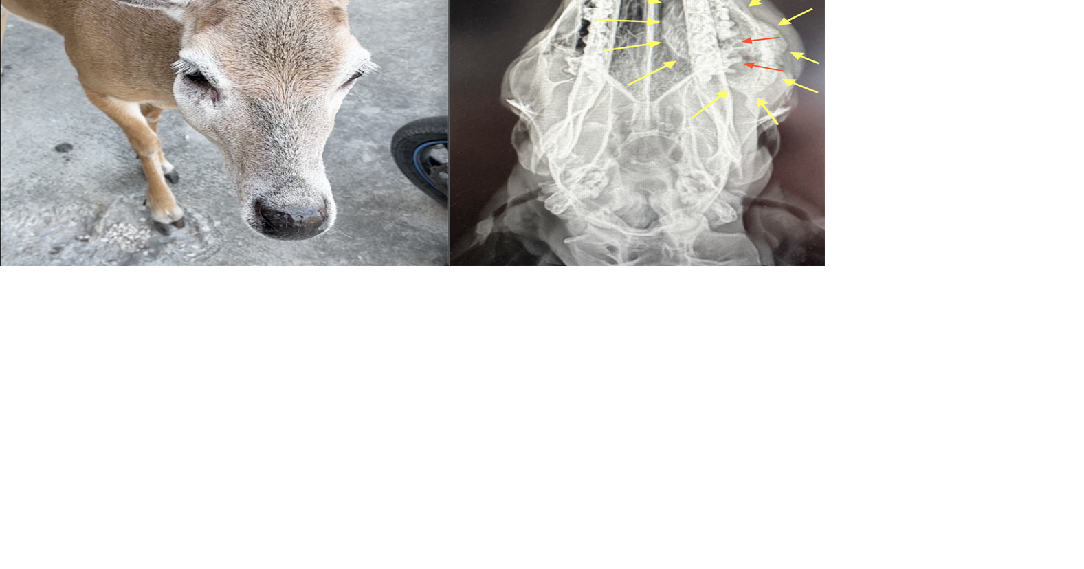 actinomyces lumpy jaw