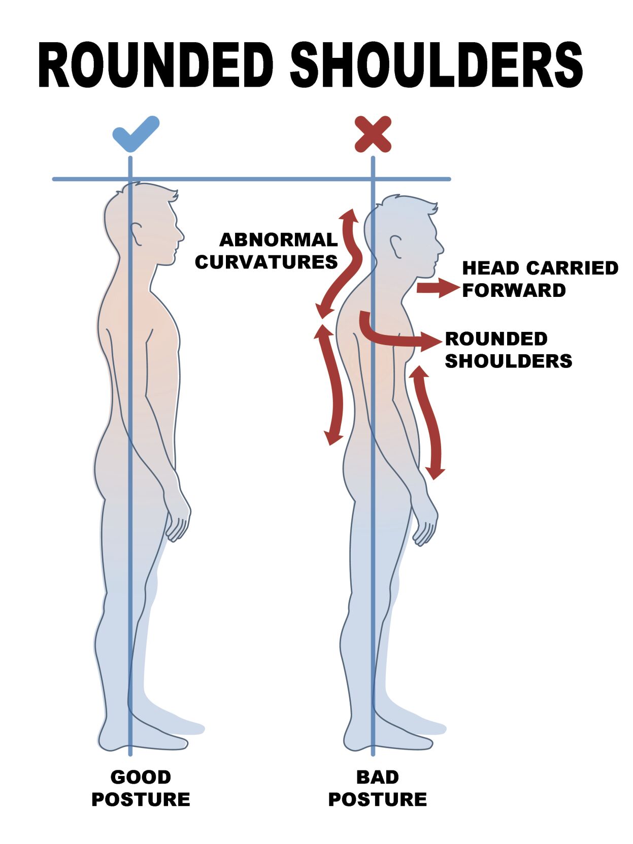 The power of posture | Columns | keysnews.com