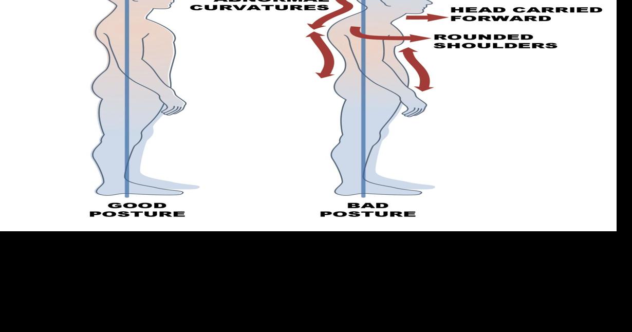 The power of posture | Columns | keysnews.com