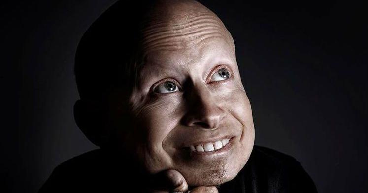 'Mini-Me' actor Verne Troyer dead at 49 | Spokane News | khq.com
