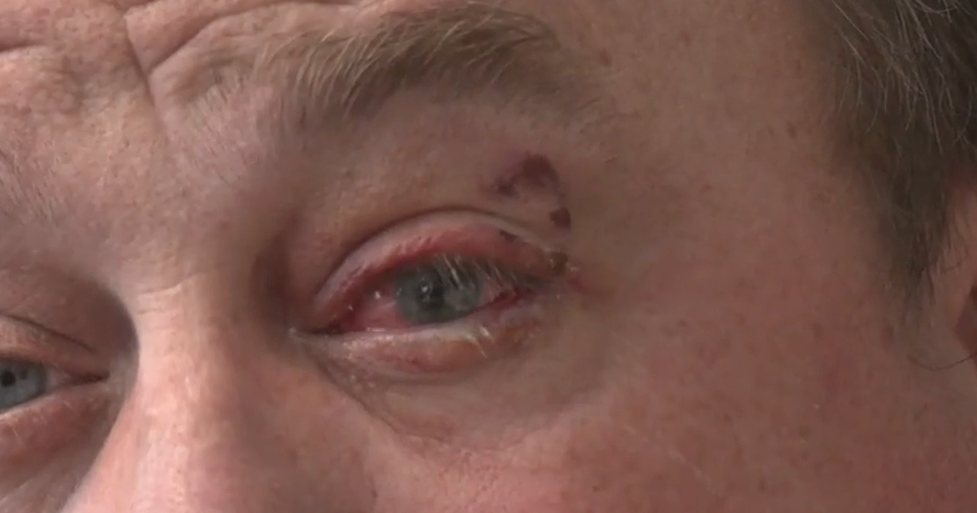 Man loses vision in one eye after hit with paintball at Spokane Valley ...