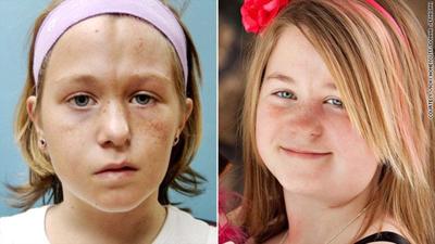 smashed face disease