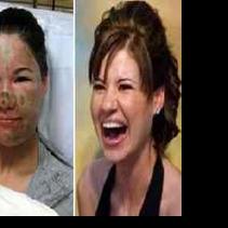 Police: Woman Could Be Charged In Self-Inflicted Acid Attack | Spokane ...