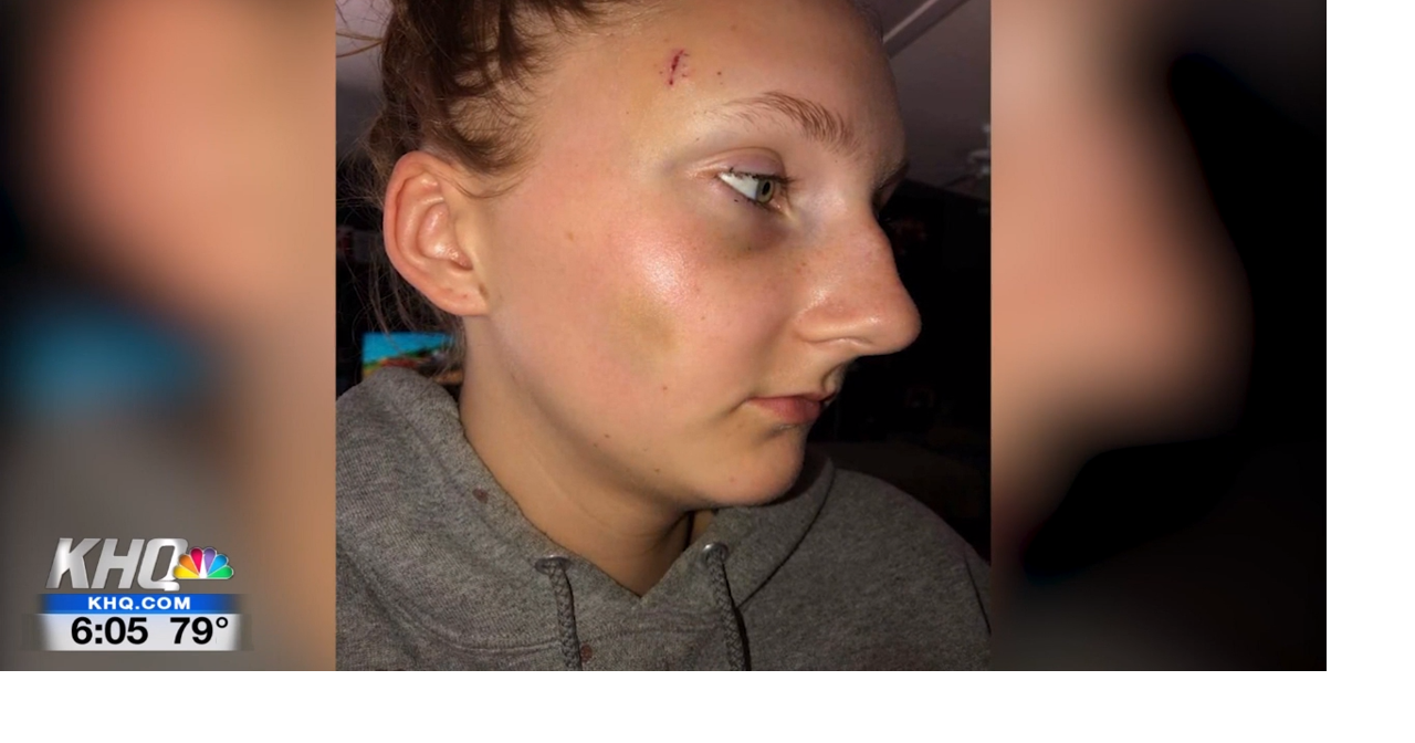 Sandpoint beating victim says she's received threats and texts that ...
