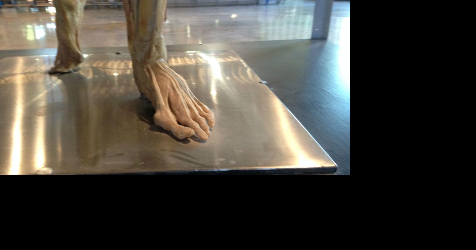 PHOTOS: 'Bodies' exhibit opening at Mobius Science Center's new ...