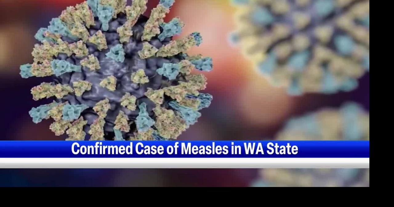 CDC reports worsening measles outbreak; Confirmed case in WA state ...
