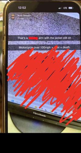 Severed Arm | | kimt.com