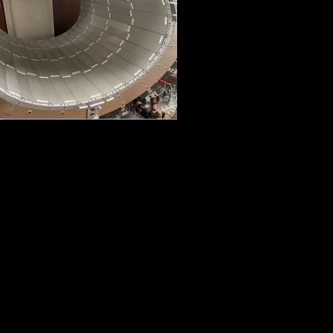 Mayo Clinic installs first Quadra PET/CT scanner in North America ...