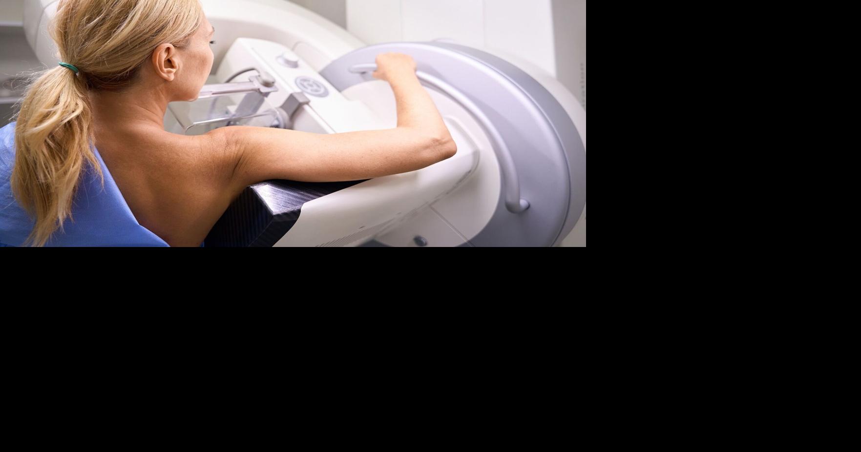 Mammograms are now recommended starting at age 40. Should you get one ...