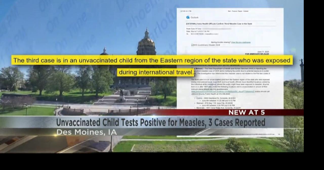 Unvaccinated child the latest of three reported measles case in Iowa ...