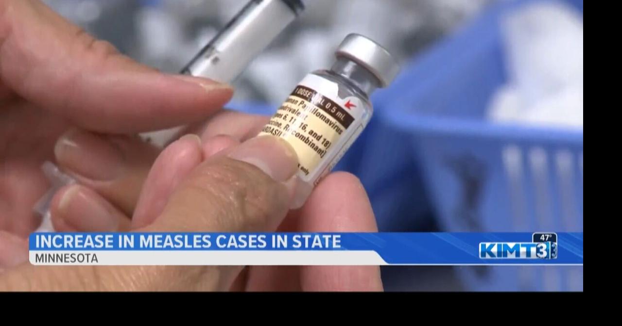 Health officials concerned by increase in measles cases in Minnesota ...